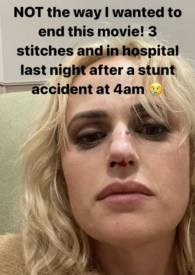 Kecelakaan Saat Syuting Film Bride Hard, Rebel Wilson Mendapat Jahitan ... Kecelakaan Saat Syuting Film Bride Hard, Rebel Wilson Mendapat Jahitan ...